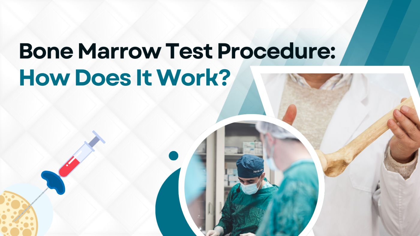 Bone Marrow Test Procedure: What It Is and How It's Performed